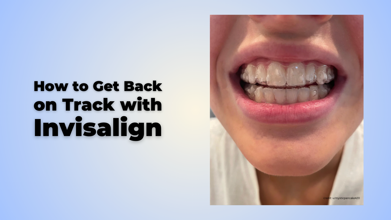 Invisalign not Tracking? Tips to Get Back on Track – PUL